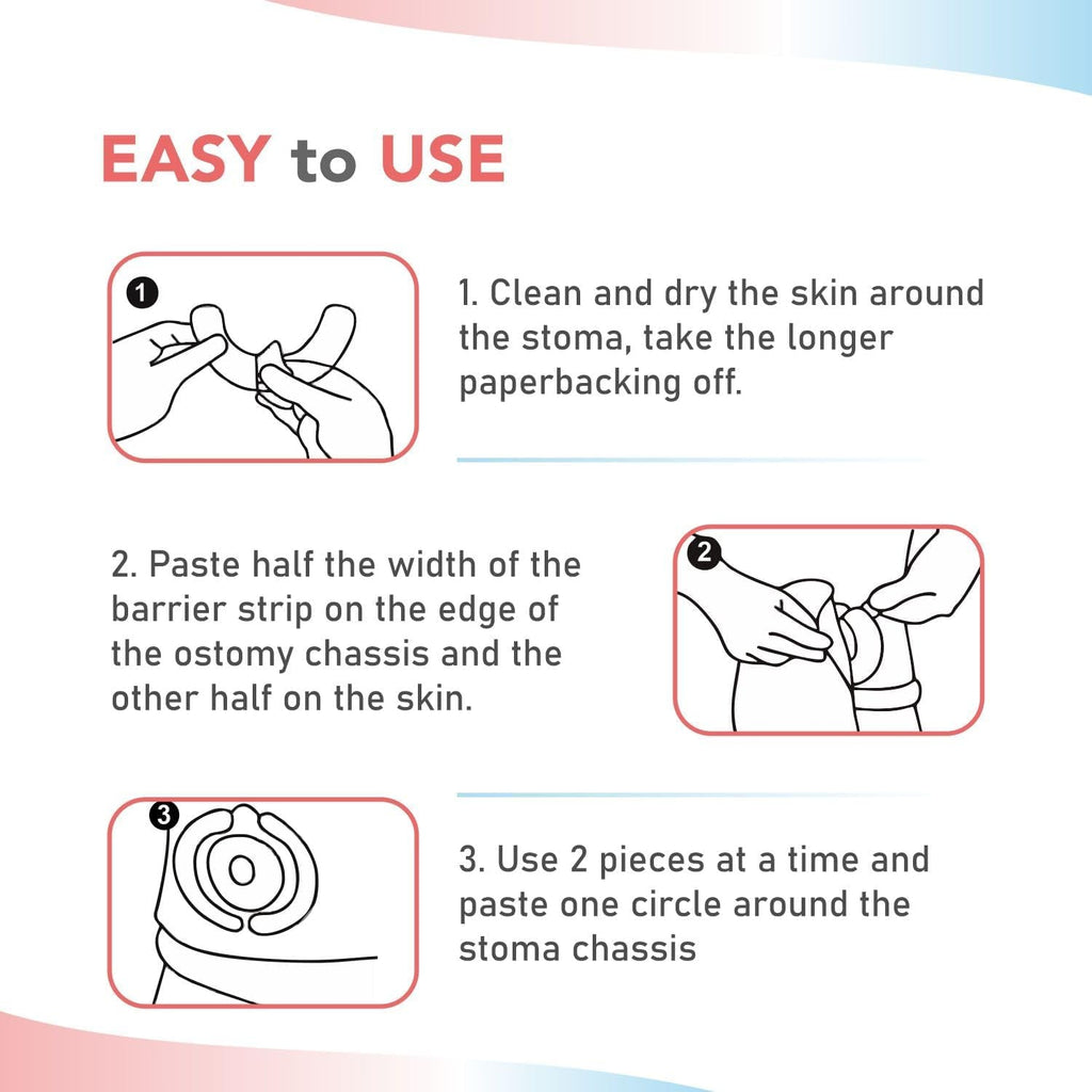 Stomalife CRESCENT BARRIER EXTENSION - 30 Extensions